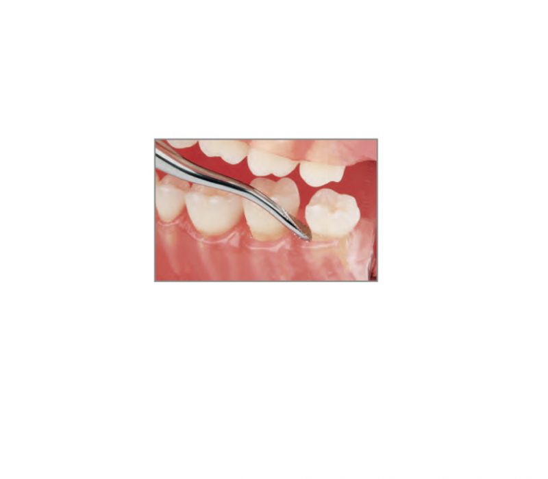 Root Elevator 3rd Molars – Biometric