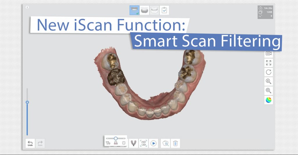 New iScan Function: Smart Scan Filtering – Biometric